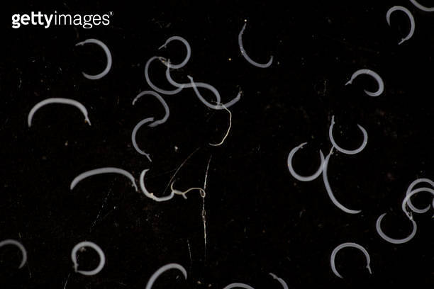 Schistosoma is a genus of trematodes, commonly known as blood flukes ...