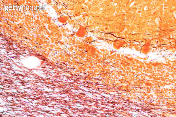 Cerebellum, Thalamus, Medulla oblongata, Spinal cord and Motor Neuron ...