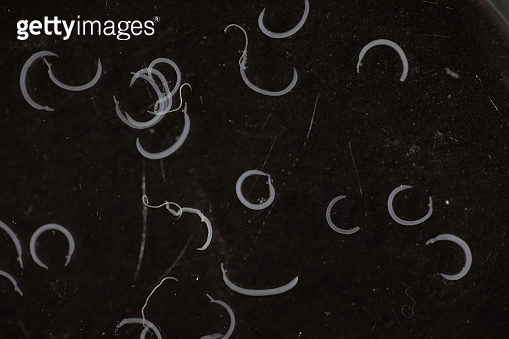 Schistosoma is a genus of trematodes, commonly known as blood flukes ...