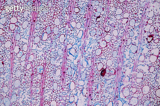 Characteristics of fungi living in wood as a group, are polyphyletic ...