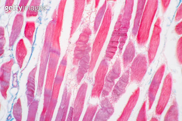 Histological sample Striated (Skeletal) muscle of mammal Tissue under ...