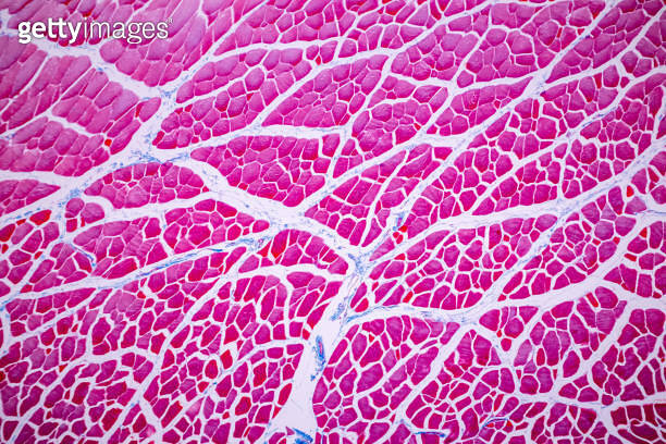 Histological sample Striated (Skeletal) muscle of mammal Tissue under ...