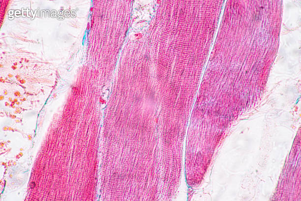 Histological sample Striated (Skeletal) muscle of mammal Tissue under ...