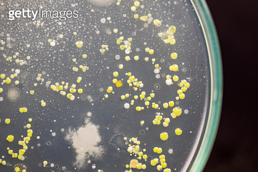 Mold Beautiful, Colony of Characteristics of Fungus (Mold) in culture ...