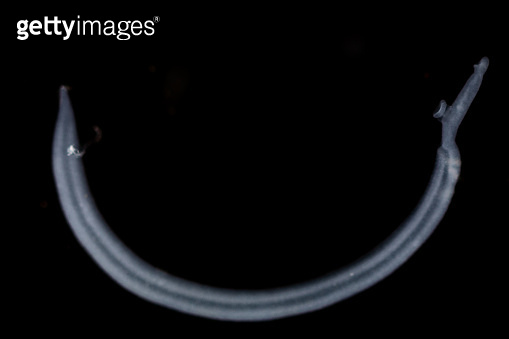 Schistosoma is a genus of trematodes, commonly known as blood flukes ...