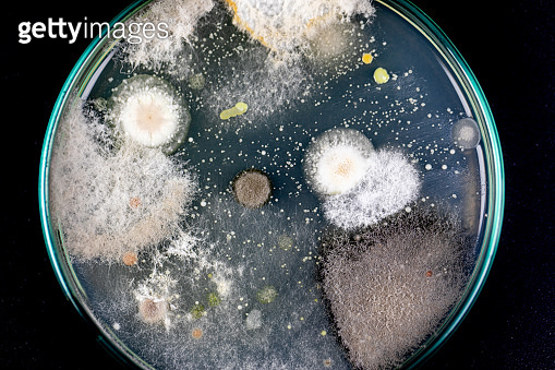 Mold Beautiful, Colony of Characteristics of Fungus (Mold) in culture ...