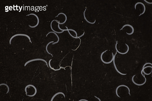 Schistosoma is a genus of trematodes, commonly known as blood flukes ...