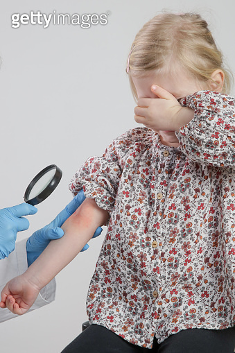 Doctor looking at red and itchy eczema on little girl's arm. Toddler ...