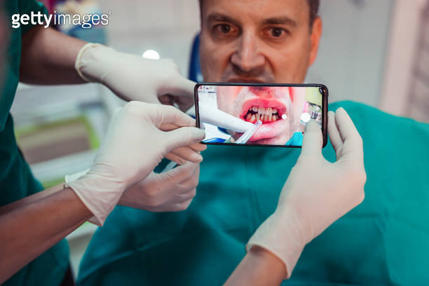Man having his teeth photographed by smart phone at dentist's office ...