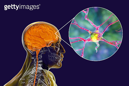 Human brain with closeup view of brain cells, neurons 이미지 (1297736502 ...