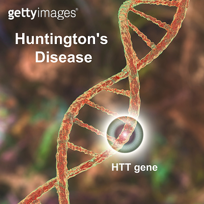 Huntington's disease, a neurodegenerative disease due to mutation in ...