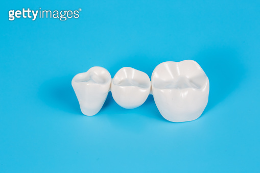 Plastic dental crowns, imitation of a dental prosthesis of a dental ...