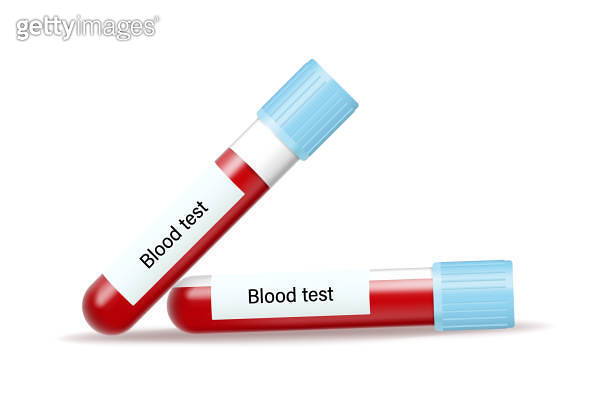Blood test. Blood in vitro. Medical laboratory. 이미지 (1386821459) - 게티이미지뱅크