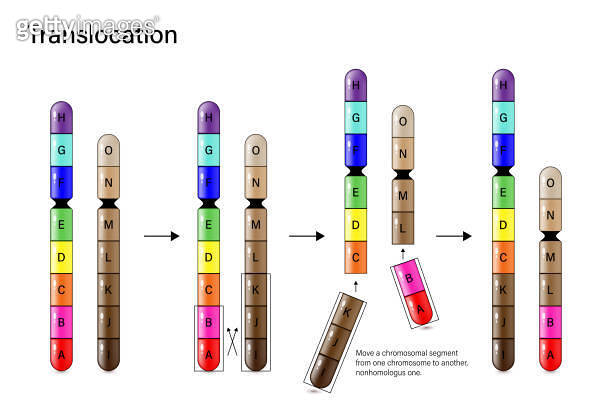 Chromosome Translocation. Genetic mutation. Alteration of chromosome ...