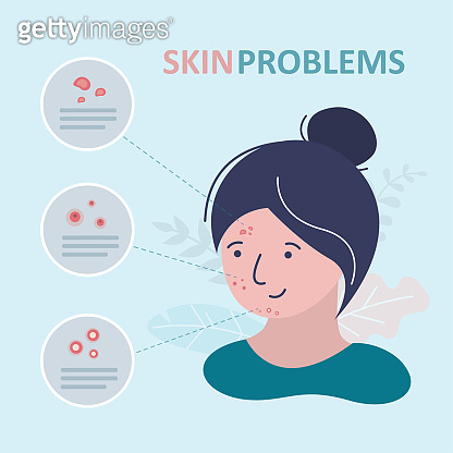 Portrait of girl with skin diseases on face. Template infographic with ...