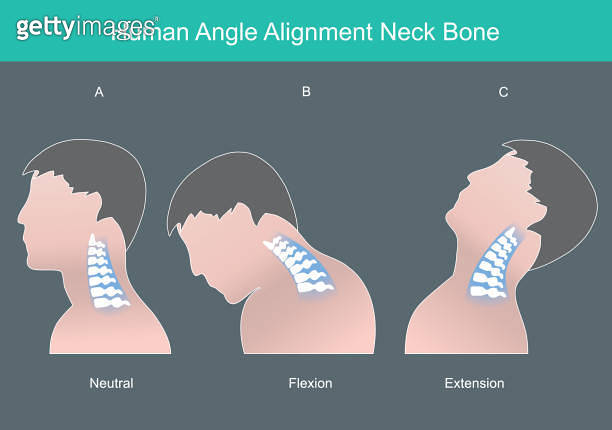 Human angle alignment neck bone. Human neck bone in correct angles ...