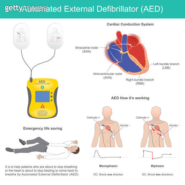 Automated External Defibrillator. It is electronic device for life ...