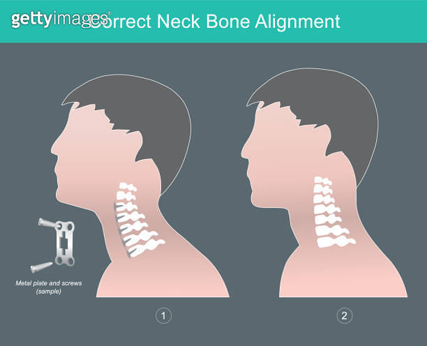 Correct Neck Bone Alignment. Showing human sideview the correct neck ...