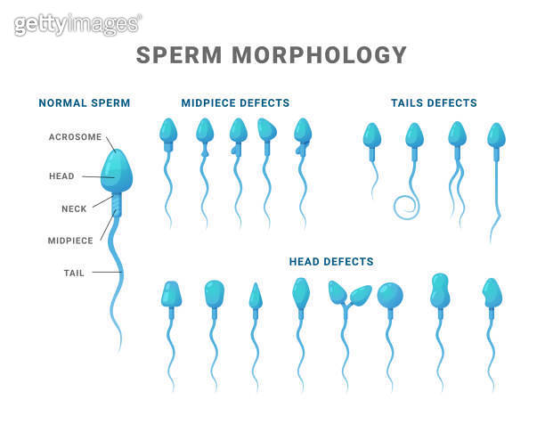 Sperm morphology count type educational medical scheme vector flat ...