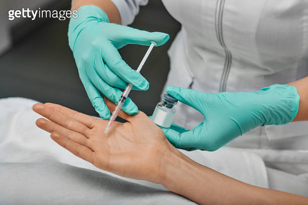 Treatment of palmar hyperhidrosis. Woman's hand during botulinum toxin ...