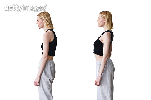 Woman with slouch and straight posture (1424425524) - 게티이미지뱅크