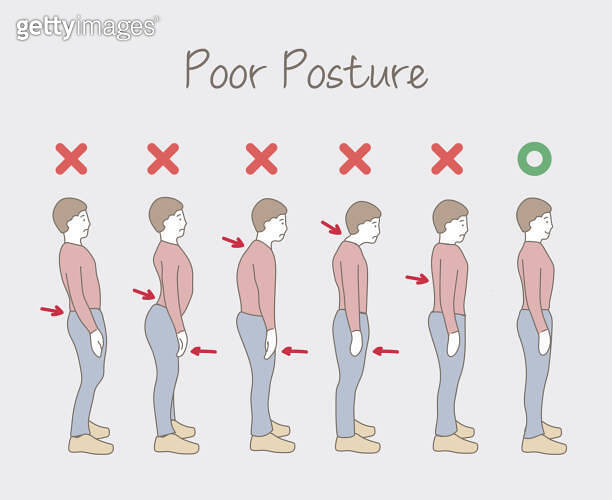 Poor and Good posture. Back and posture problems illustrations set ...