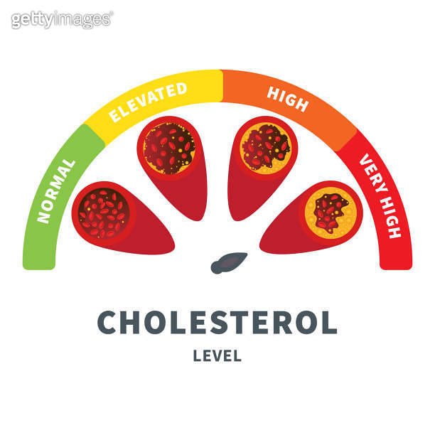 Cholesterol level meter gauge with blood vessel diagram (1434405410 ...