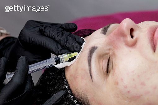 Cosmetologist doctor is making multiple injections biorevitalization ...