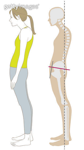Sideways woman and skeleton standing in stooped, sway-back posture 이미지 ...