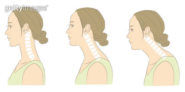 Woman with normal cervical spine and straight neck 이미지 (1439478533 ...
