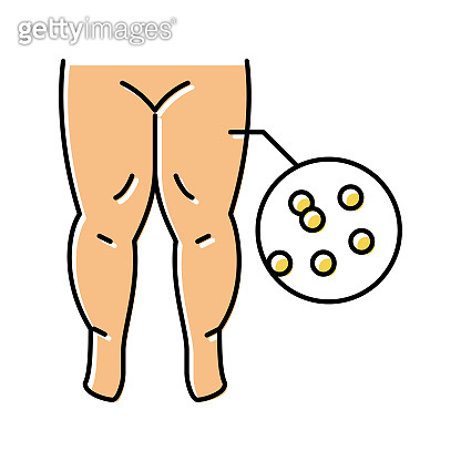 hypoproteinemic edema color icon vector illustration (1388166331) 일러스트 ...