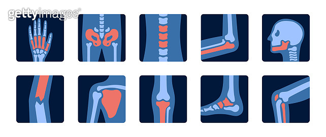 X-rays of human joint anatomy with pain parts. X-ray examination of ...