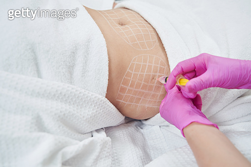 Dermatologist is doing injection into the subcutaneous fat in aesthetic ...