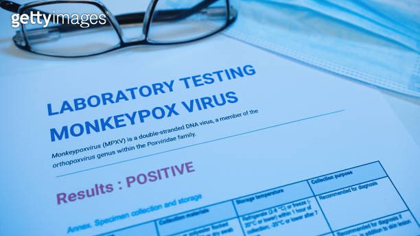 Glasses and data sheet on monkeypox test positive results in a ...