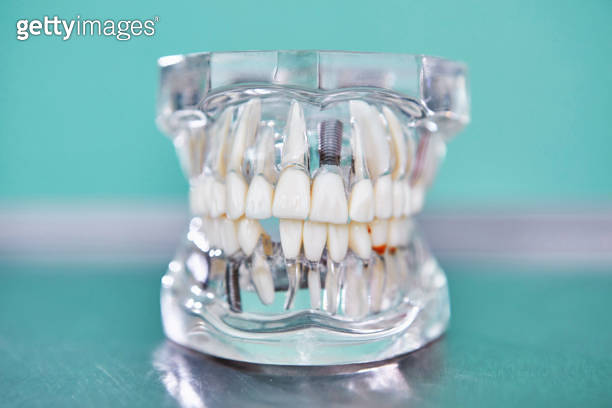 Transparent Model of a human jaw showing teeth, roots, gums, gum ...