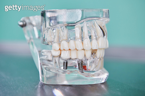 Transparent Model of a human jaw showing teeth, roots, gums, gum ...