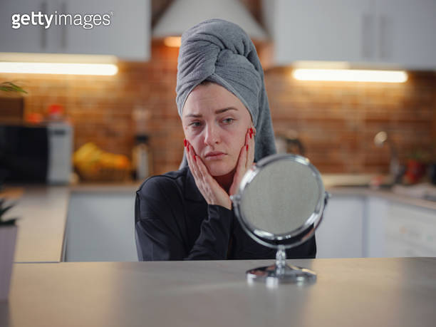 woman feeling shock while looking acne and scar occur on face 이미지 ...