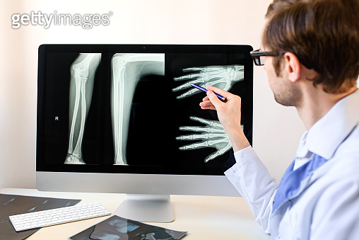 radiologist analyzing a patient with arthritis arm, forearm and hand ...