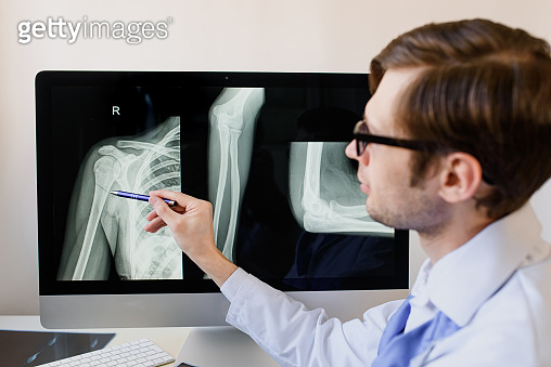 radiologist analyzing a patient arm and forearm bones x ray with a ...