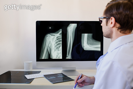 radiologist analyzing a patient arm and foream bones x ray. 이미지 ...