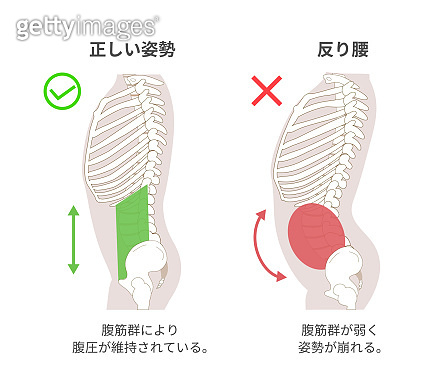 Diagrammatic illustration of the relationship between abdominal muscle ...