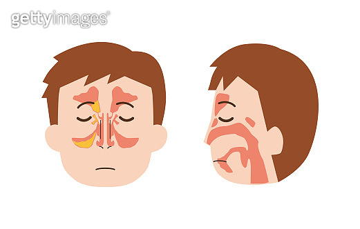 Internal image of the nose Front and sides 이미지 (1375780954) - 게티이미지뱅크