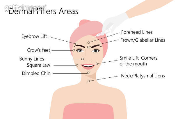 Dermal filler injections areas. Woman face with doctor hands in gloves ...
