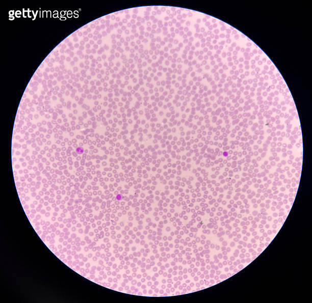 Red blood cell and white blood cells in 40X microscope. 이미지 (1412174022 ...