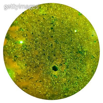 Sputum or phlegm smear Fluorescence (FM) stained LED microscopic 20x ...