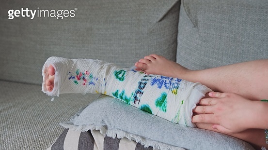 Young Caucasian Girl Resting on Couch Scratching Itchy Skin on Injured ...