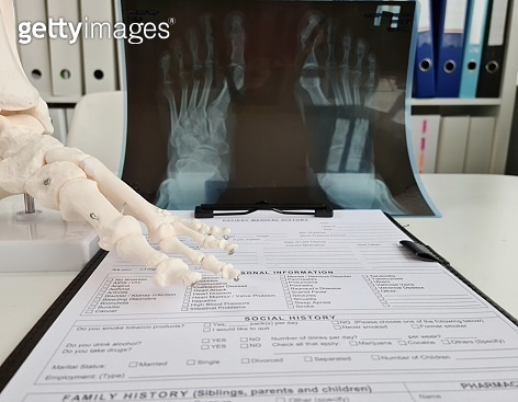 X-ray image of leg mock-up and patient medical record closeup ...