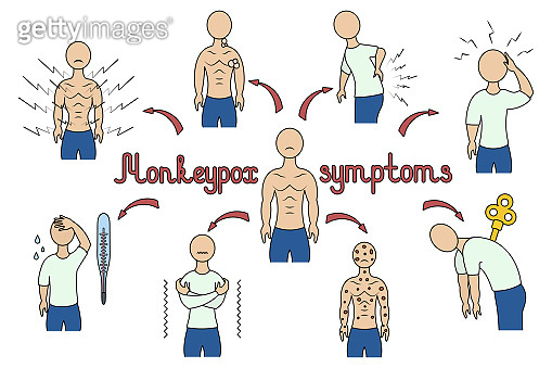A group of signs of monkey pox. Color vector illustration. Cartoon ...