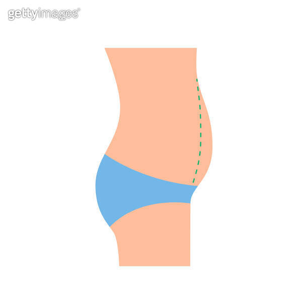 Protruding belly of woman, correction big fat belly, tummy tuck ...