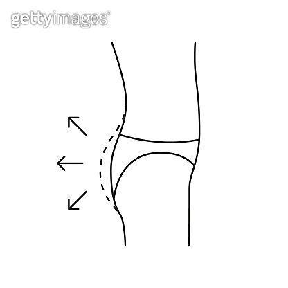 Buttock increase of woman, shape buttock side, line icon. Augmentation ...